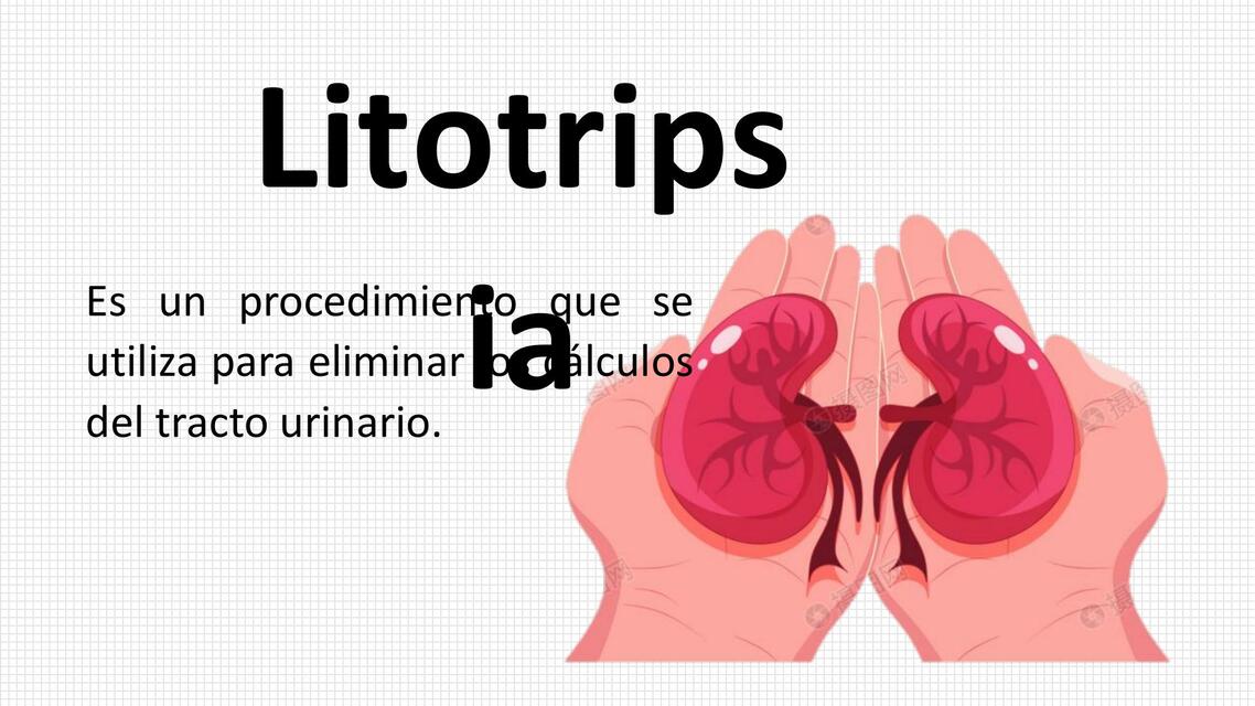 Litotripsia | TANIA LIZETH ROJAS FUSTAMANTE | uDocz