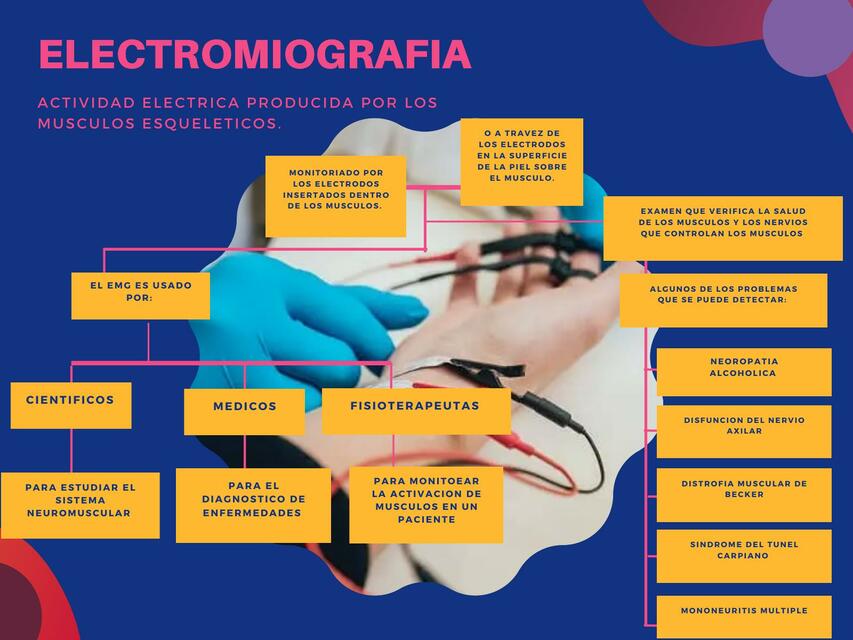 Electromiografía | Marielena Garcia | uDocz