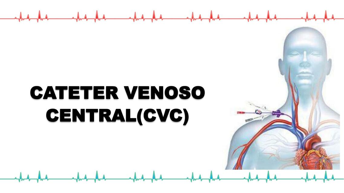 Catéter Venoso Central | Leni Angel | uDocz