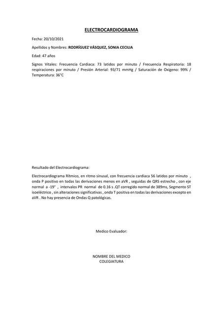 Informe de Electrocardiograma | gianella stucchi | uDocz