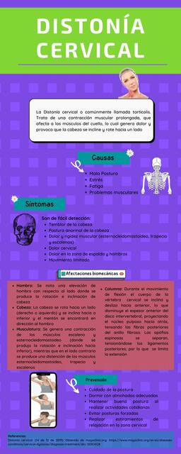 Distonía Cervical | Ana Garcia | uDocz