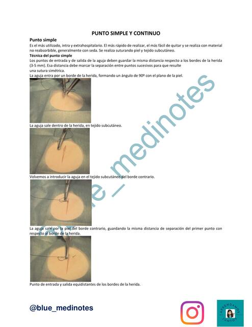 Punto Simple y Continuo | @blue_medinotes | uDocz