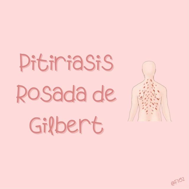 Pitiriasis Rosada de Gilbert | uDocz