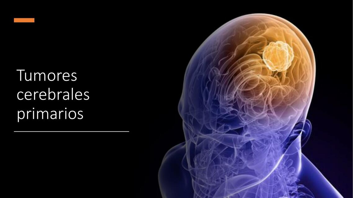 Tumores Cerebrales Primarios | Andree Gm | uDocz