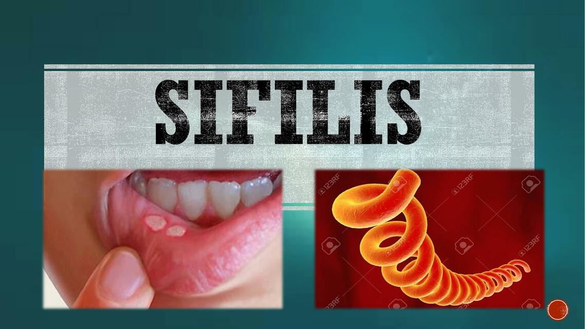 Sífilis | MARIA FERNANDEZ FARFAN | uDocz