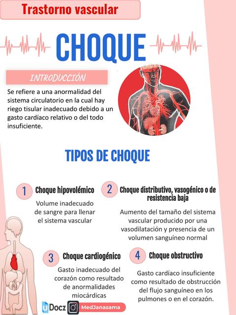 Trastorno vascular : CHOQUE | Med Jana sama | uDocz