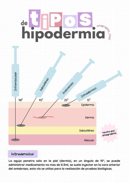 Tipos de Hipodermia | anagraphis med | uDocz
