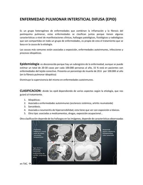 Enfermedad pulmonar intersticial difusa EPID | JOHN SEBASTIAN JIMENEZ PORTILLA | uDocz