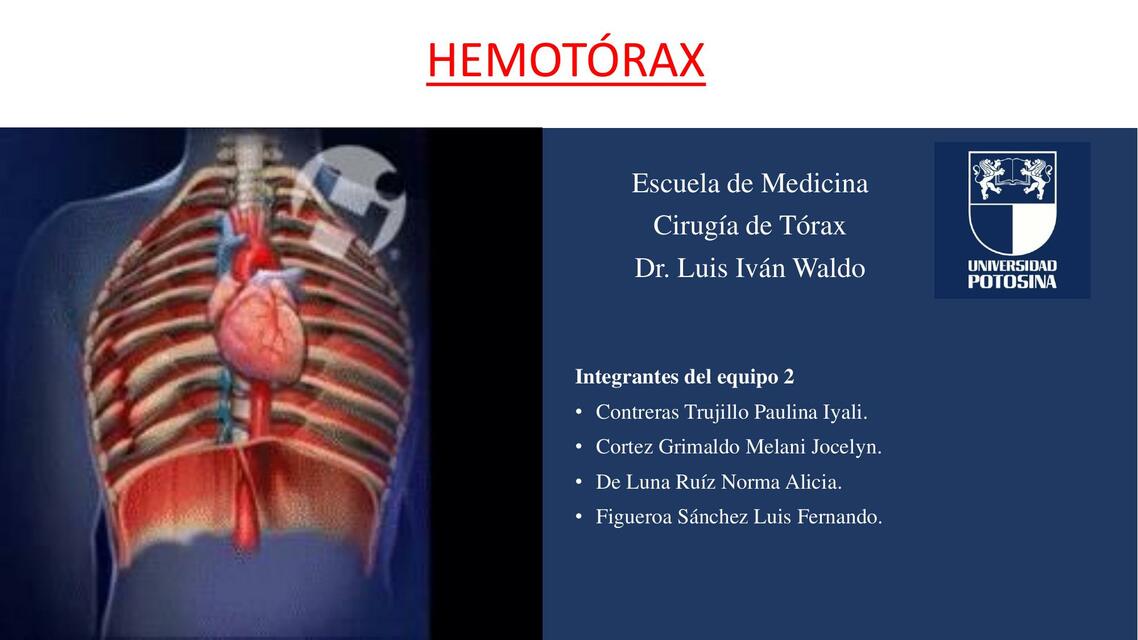 Resúmenes de Hemotórax | Descarga apuntes de Hemotórax