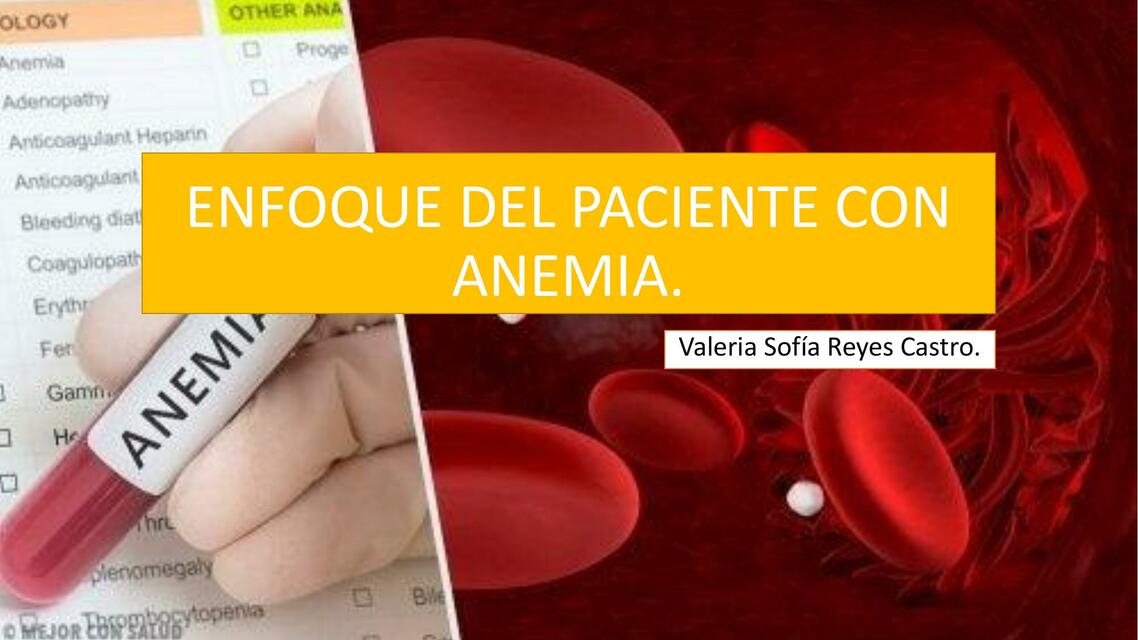 Enfoque del Paciente con Anemia | Valeria Sofia Reyes Castro | uDocz