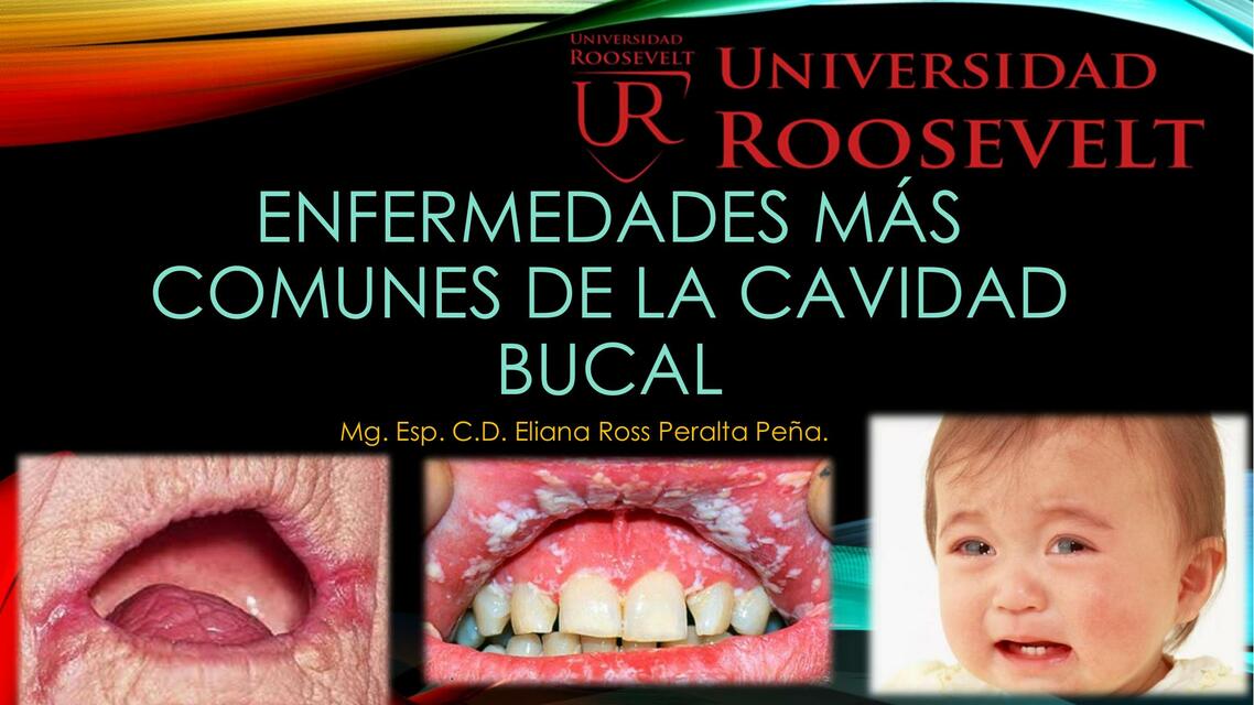 Enfermedades Más Comunes de la Cavidad Bucal | Katy M. Quispilaya ... Enfermedades Más Comunes de la Cavidad Bucal | Katy M. Quispilaya ...