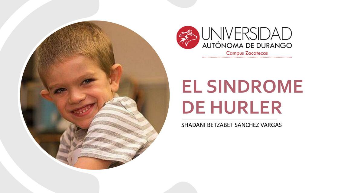 El síndrome de Hurler | Betzabet