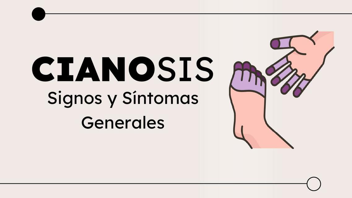 Resúmenes de Cianosis | Descarga apuntes de Cianosis
