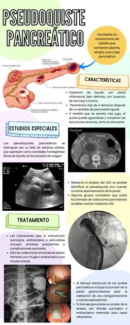 Pseudoquiste Pancreático | Karla Arce | uDocz