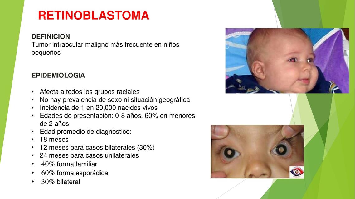 Diagrama De Retinoblastoma