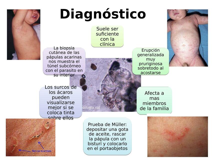 Escabiosis | Karina Perez | uDocz