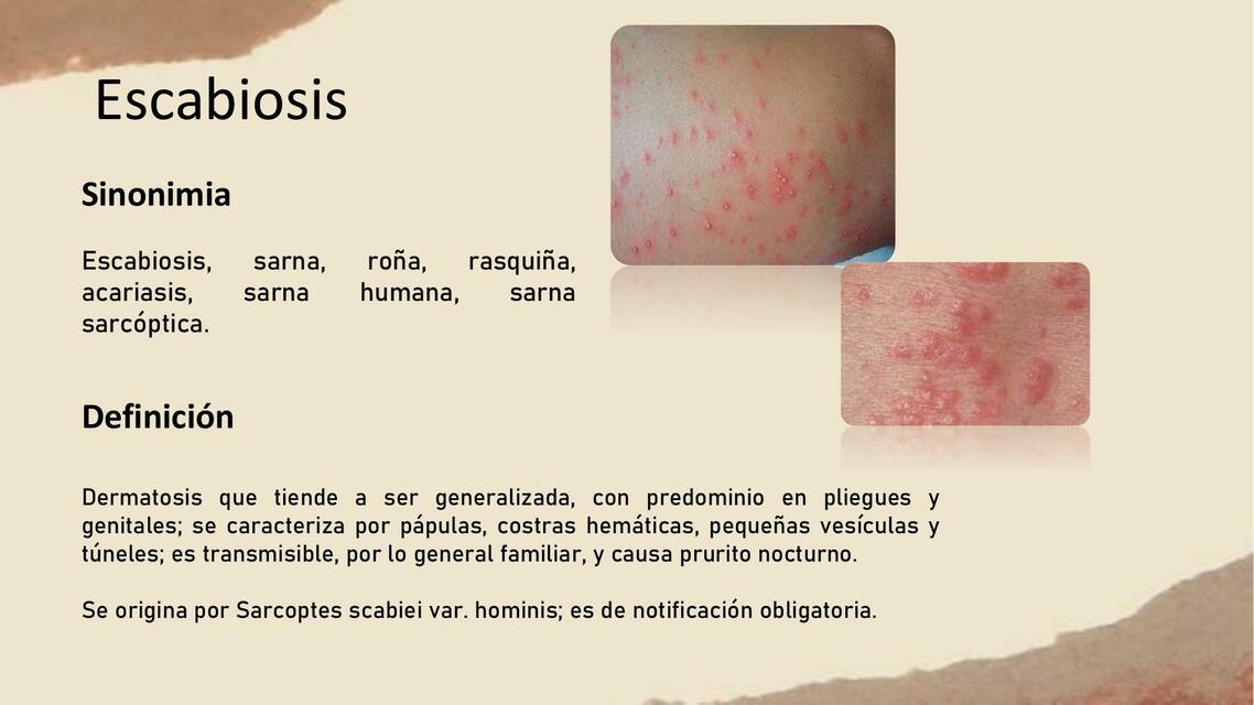 Escabiosis | Alba Pichardo López | uDocz