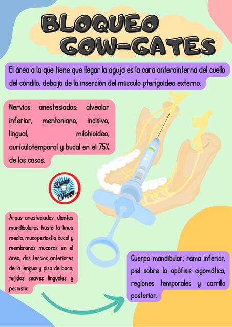 Bloqueo (GOW-GATES) | Alan Díaz | uDocz