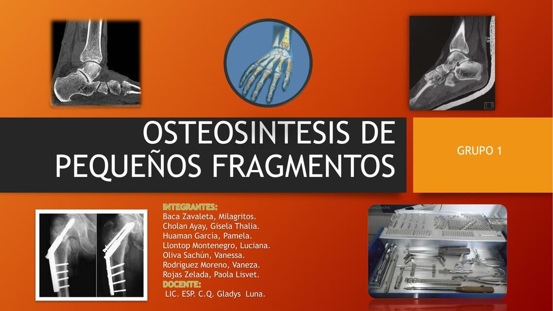 Osteosíntesis de Pequeños Fragmentos | Analy Rodriguez | uDocz