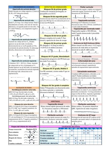 ECG | uDocz