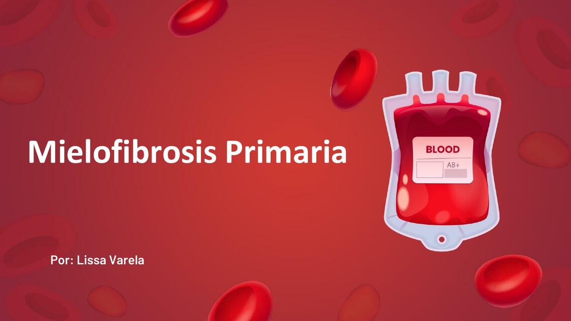 Flashcards de Mielofibrosis Primaria | Por lissa Varela | uDocz