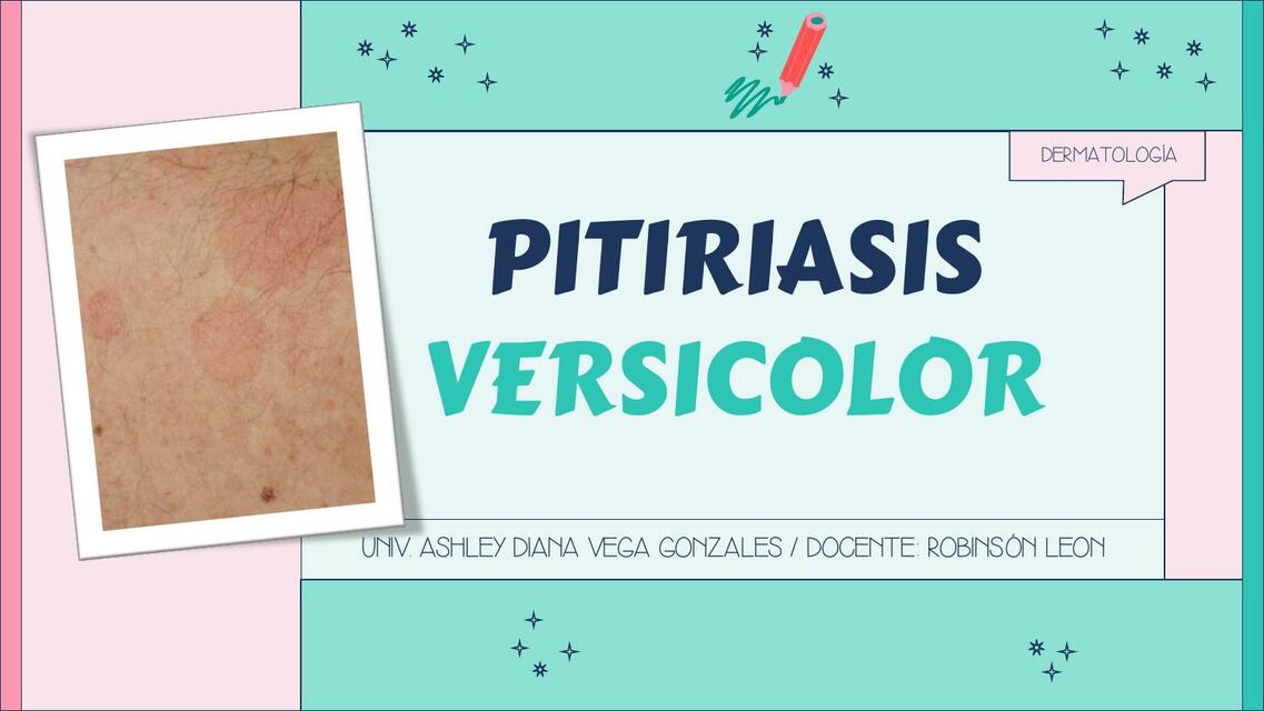 Pitiriasis Versicolor | uDocz
