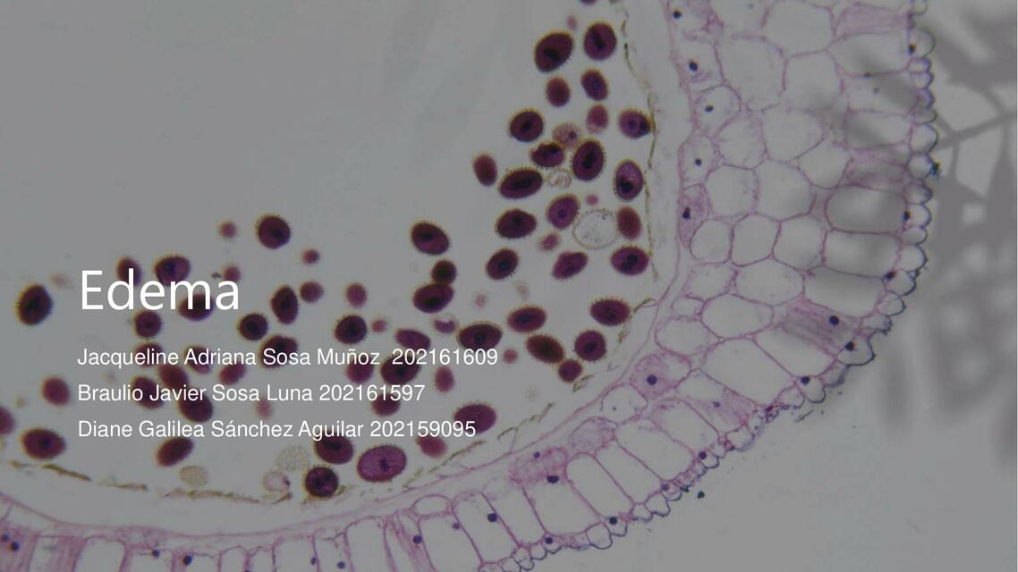Resúmenes de Tipos de edema | Descarga apuntes de Tipos de edema