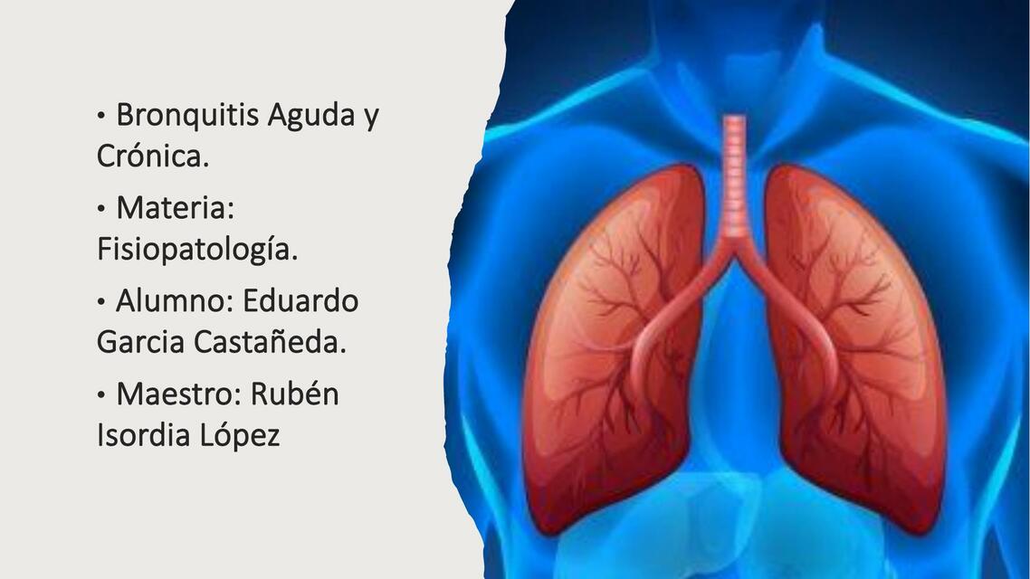 Bronquitis Aguda y Crónica | eduardo garcía castañeda | uDocz