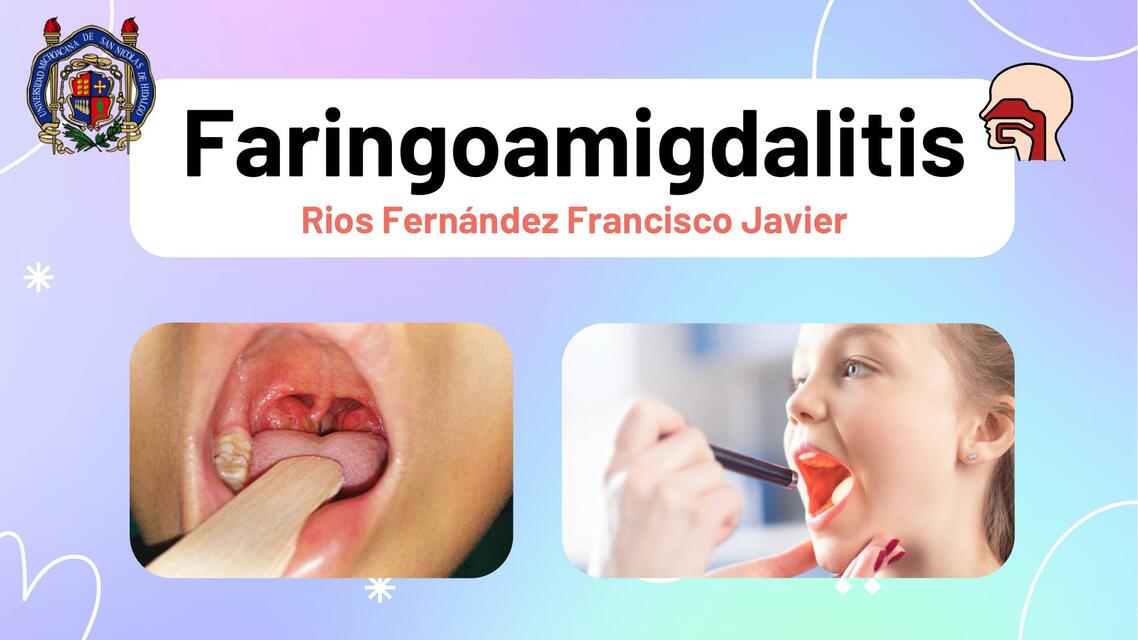 Faringoamigdalitis