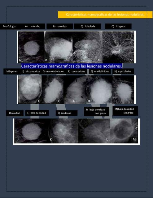 Características mamográficas de las lesiones nodulares | uDocz
