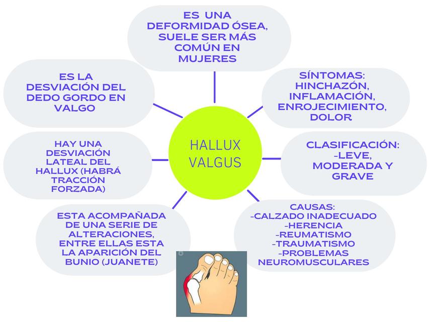 Hallux Valgus