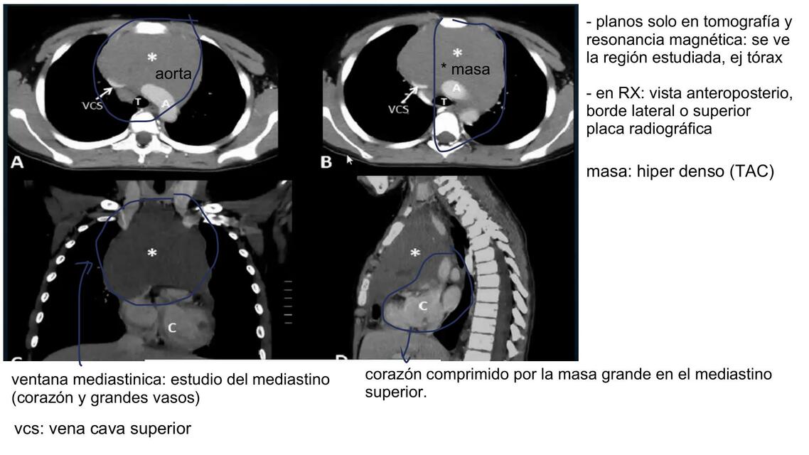 RX D TÓRAX | Adriana Mendoza | uDocz