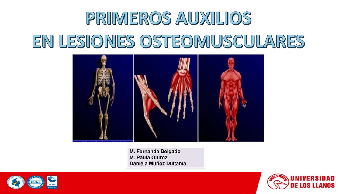 FRACTURAS 🍗 | uDocz