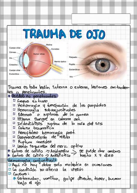 Trauma de ojo | Valentina Lopez | uDocz