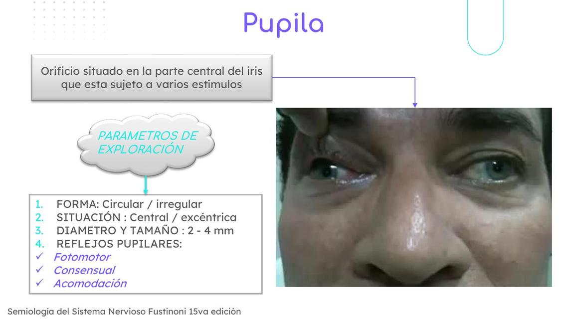 La pupila | Doctor_teco | uDocz