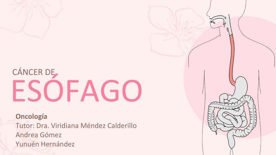 Cáncer esofágico | Busca y descarga apuntes gratis | uDocz