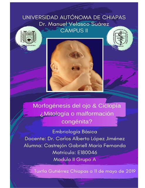 Morfogénesis del Ojo y Ciclopía | María Fernanda Castrejón Gabriell | uDocz