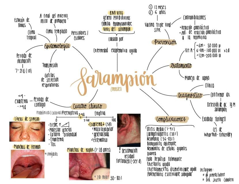 Sarampión Pediatría | Josefa (@jomedstudent) | uDocz