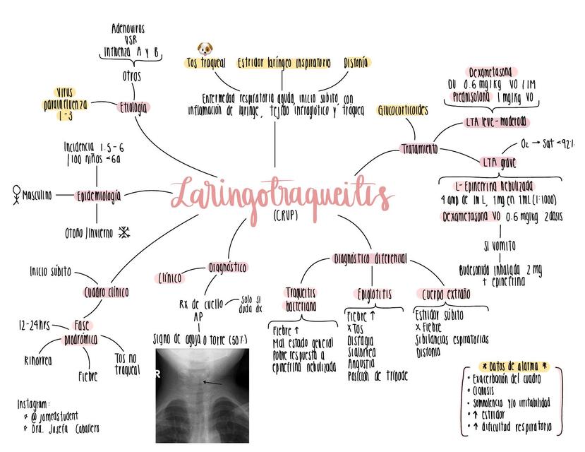 Resúmenes de Laringotraqueitis | Descarga apuntes de Laringotraqueitis