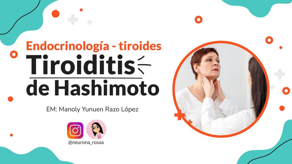 Tiroiditis de Hashimoto | Manoly Razo | uDocz