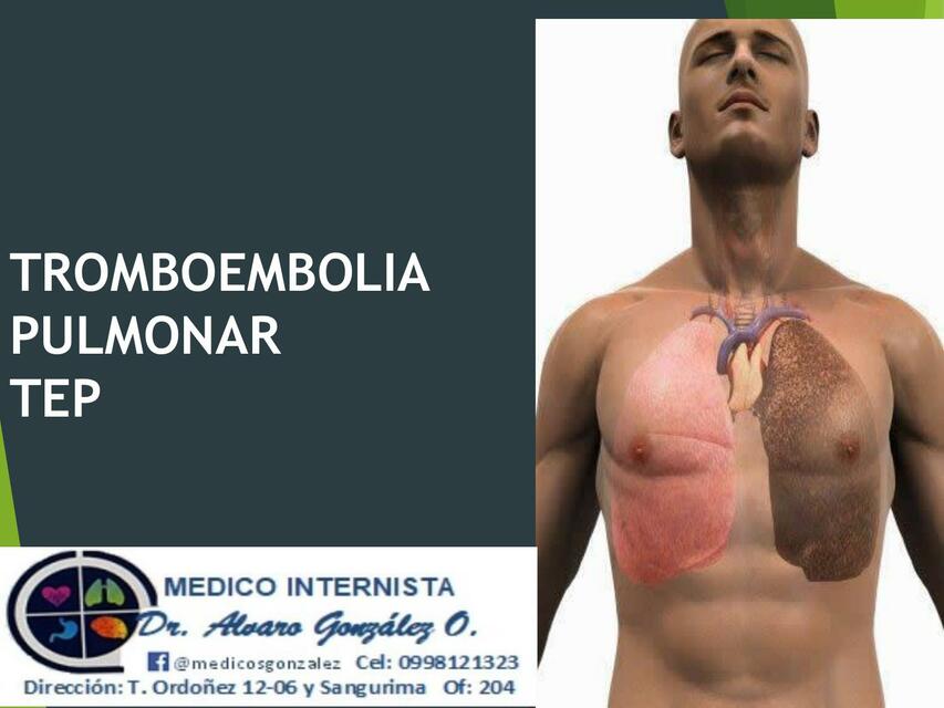 Resúmenes de Tromboembolia pulmonar | Descarga apuntes de Tromboembolia ...