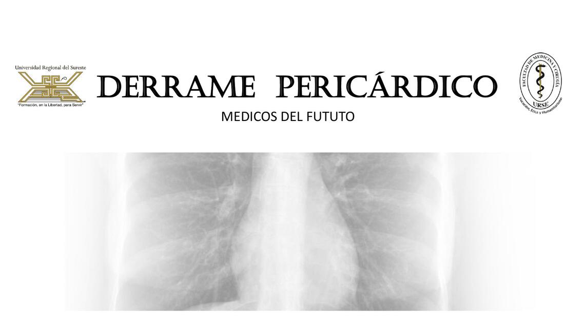 Derrame Pericárdico y Taponamiento Cardiaco | Christina Stangl | uDocz