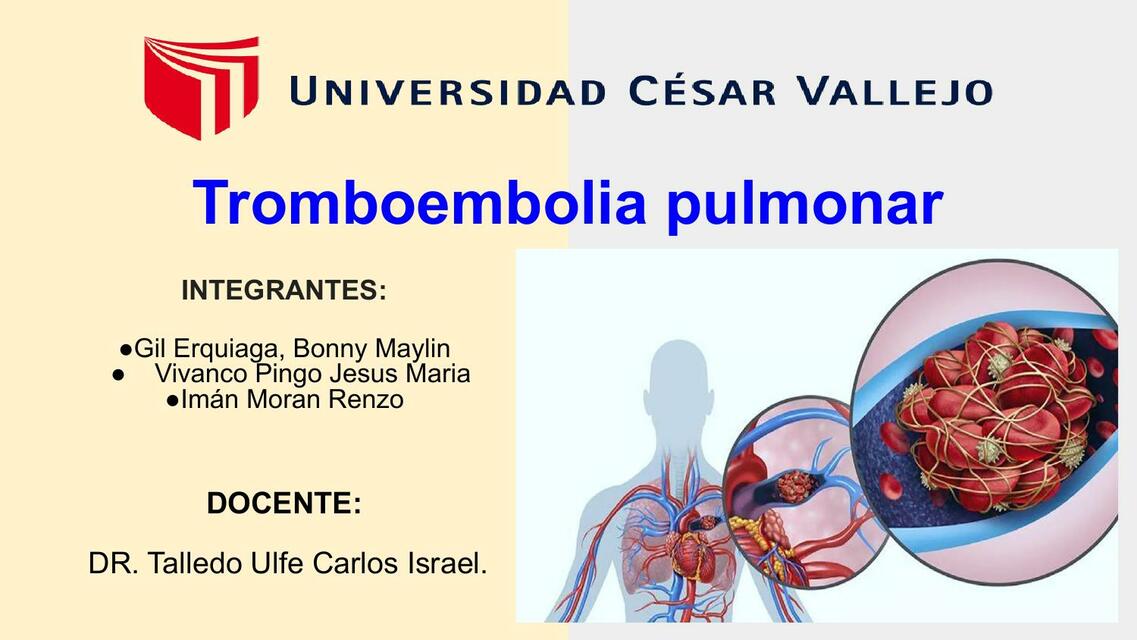 Tromboembolia Pulmonar | Bonny maylin Gil erquiaga | uDocz
