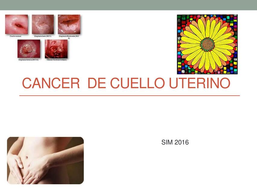 Cancer de cuello uterino | futuramedica encolores | uDocz