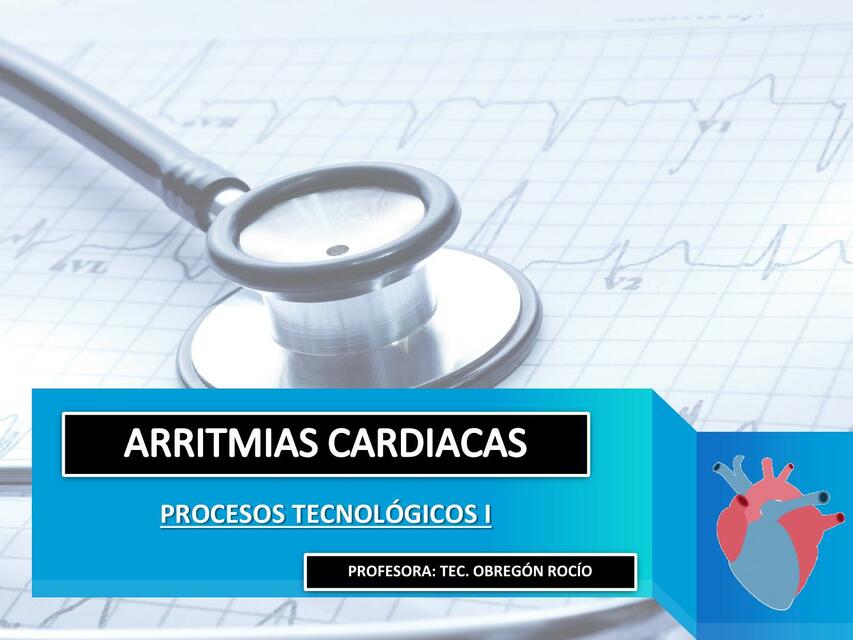 Arritmias Cardiacas | Carla Lu | uDocz