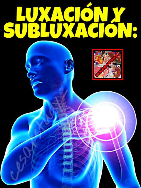 Luxación y subluxación | Cesarstudy_ | uDocz