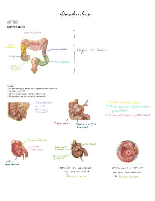 Apendicectomía | Varthies | uDocz