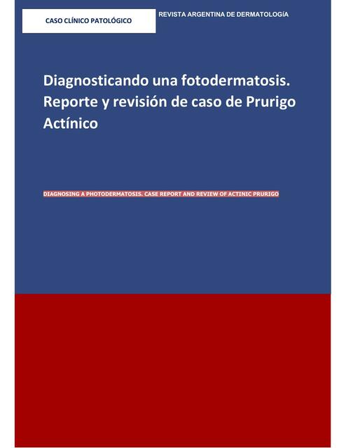 Diagnóstico de una Fotodermatosis | Dermatología médica | uDocz