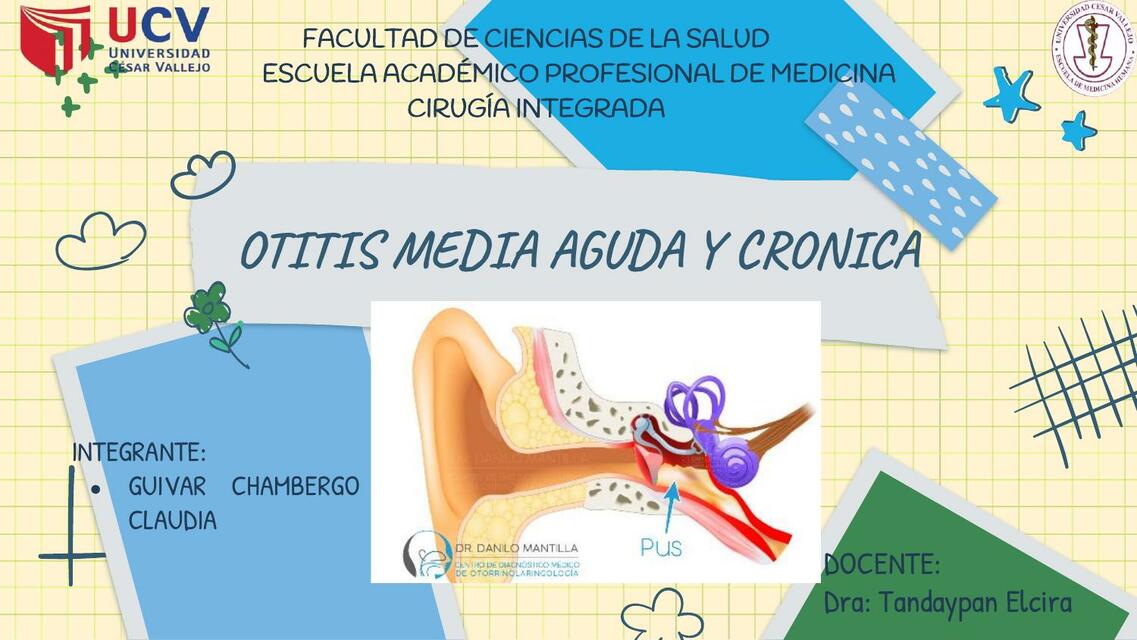 Otitis Media Aguda y Crónica | STEFANY CLAUDIA GUIVAR CHAMBERGO | uDocz
