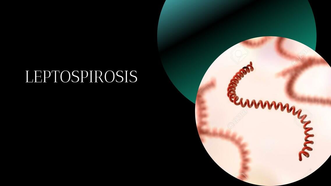 Leptospirosis | Stefania Castillo | uDocz